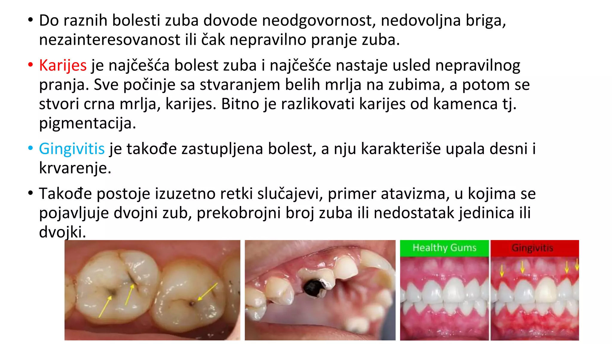 PREZENTACIJA O ZUBIMA (1).pptx