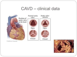CAVD | PPTX | Endocrine and Metabolic Diseases | Diseases and Conditions