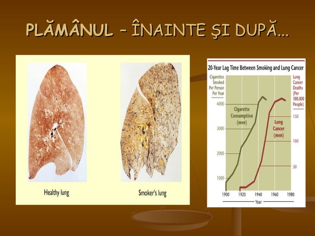 Prezentare anti-fumat | PPT