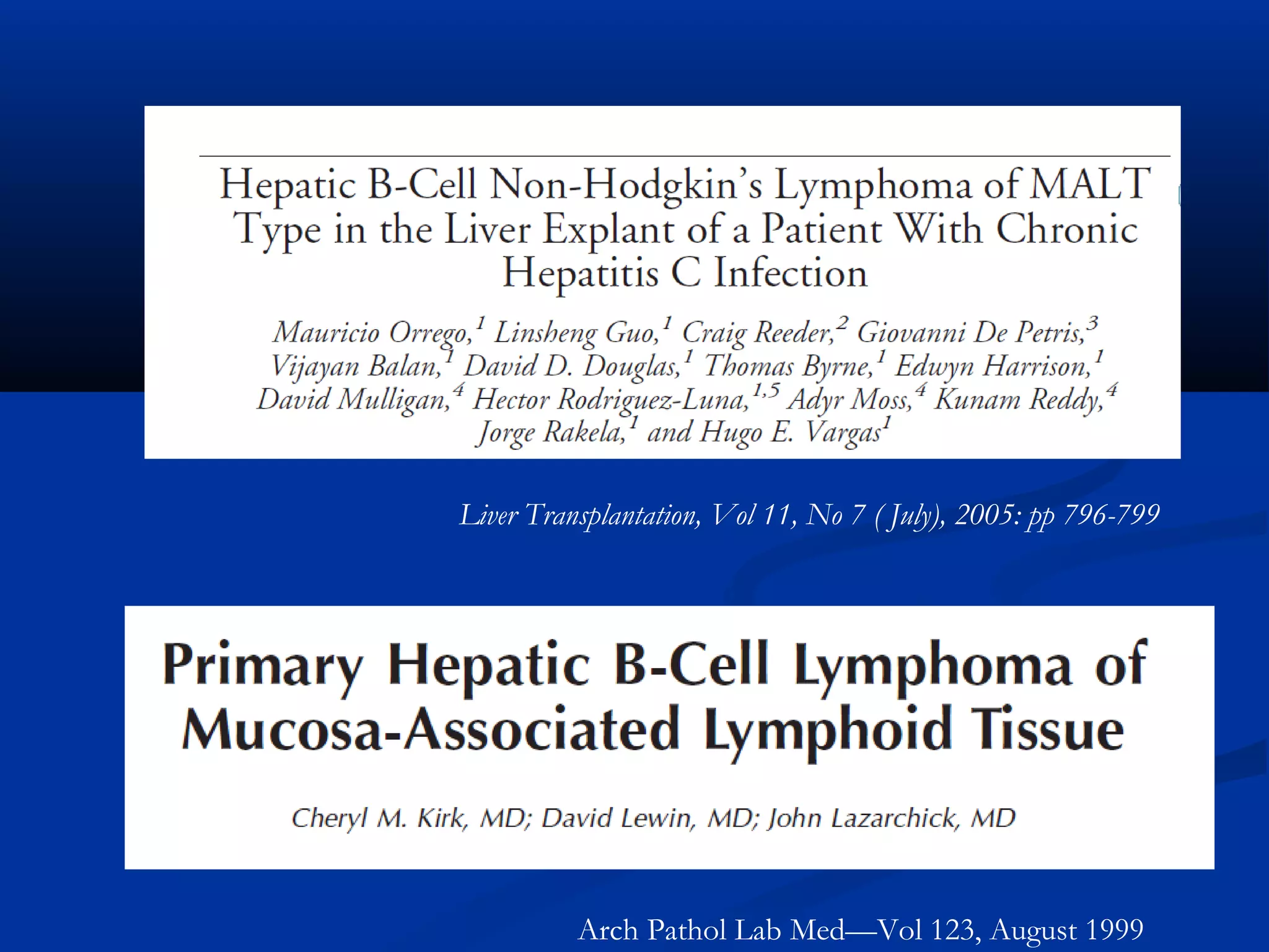 Prezentare limfom | PPT