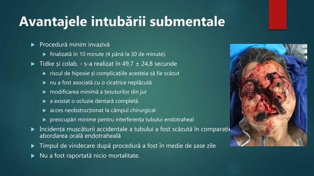 Prezentare Microsoft PowerPoint nou.pptx