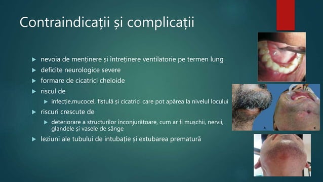 Prezentare Microsoft PowerPoint nou.pptx