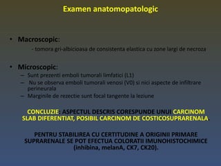 Carcinom suprarenala | PPT