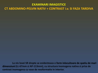 Carcinom suprarenala | PPT