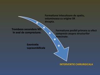 Carcinom suprarenala | PPTX
