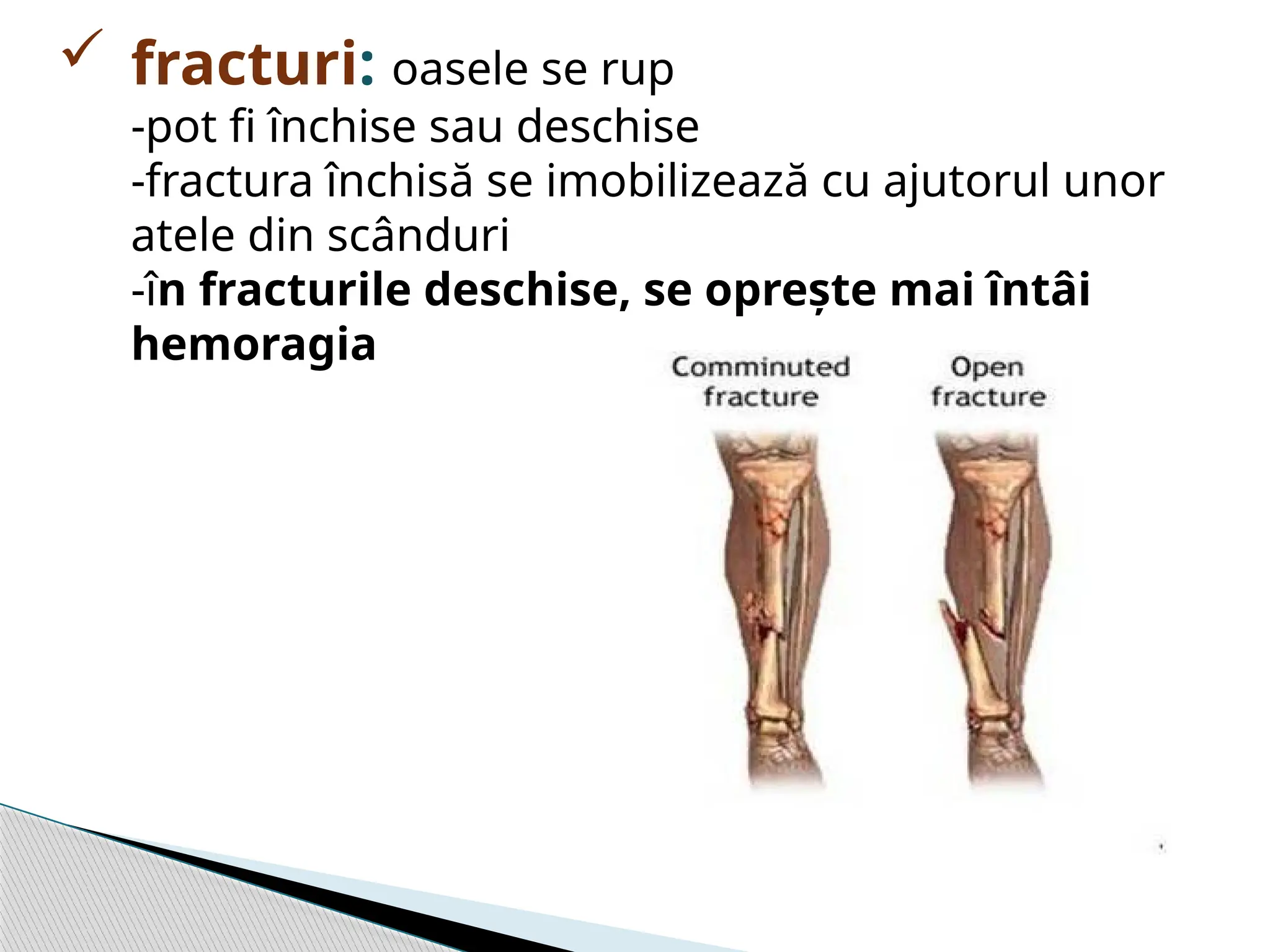 prezentare_sistemul_locomotor p_ppt.pptx