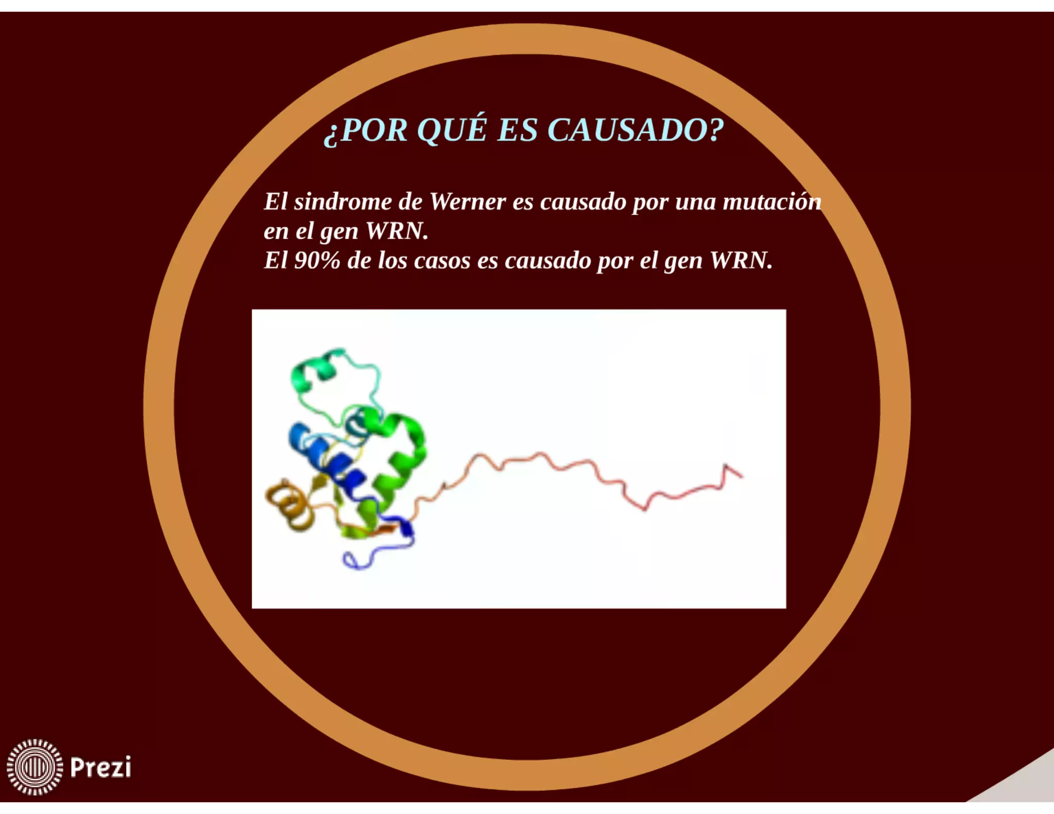 Prezi (sindrome de werner) | PDF