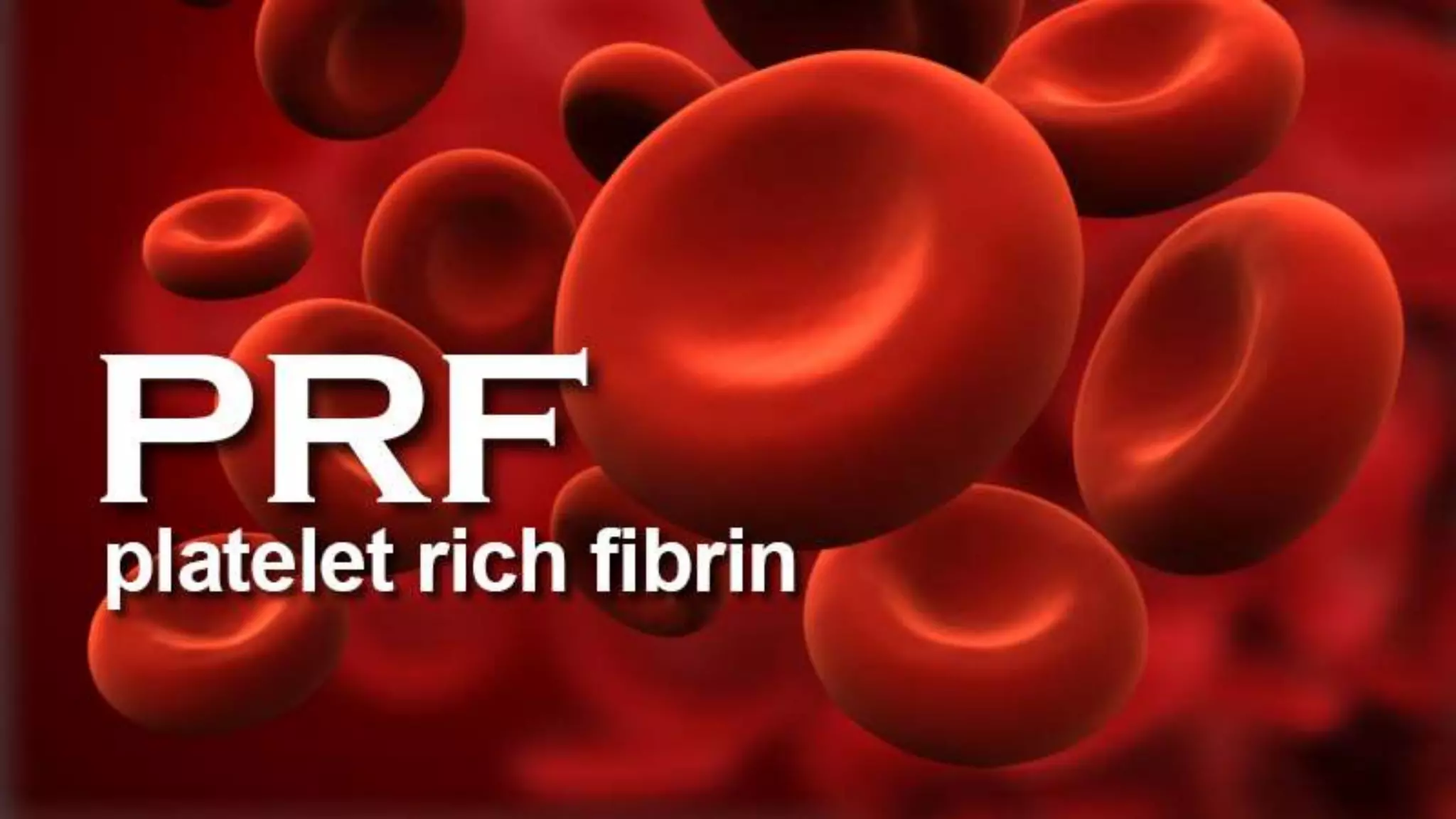 Platelet rich fibrin | Dental Implants with PRF | PRF In regenerative ...