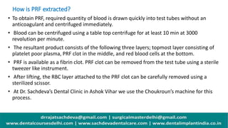 Platelet rich fibrin | Dental Implants with PRF | PRF In regenerative ...