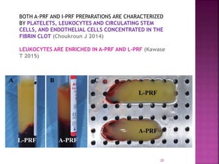 PLATELET RICH FIBRIN - ROLE IN PERIODONTICS | PPTX