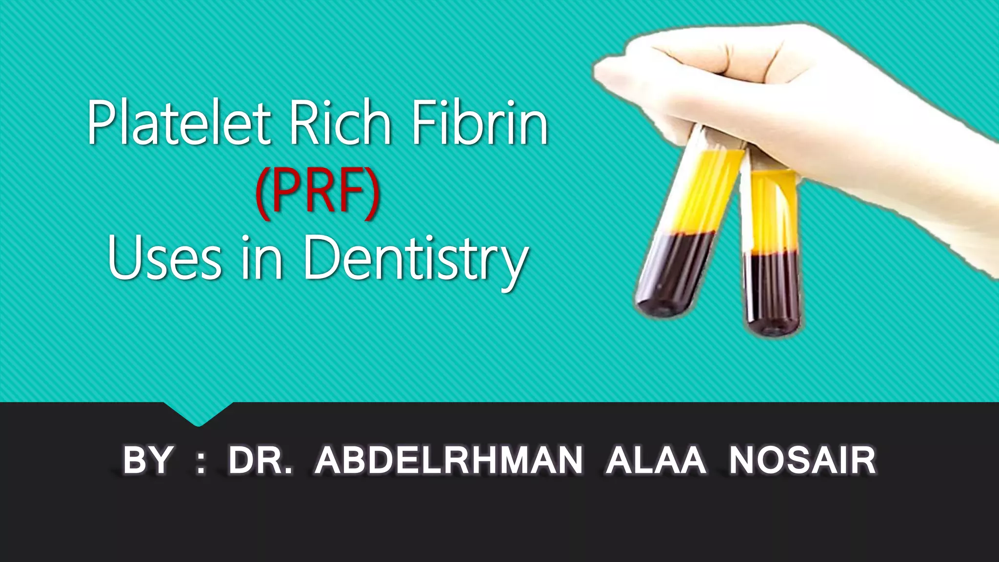 Platelet Rich Fibrin (PRF) in Dentistry | PPTX