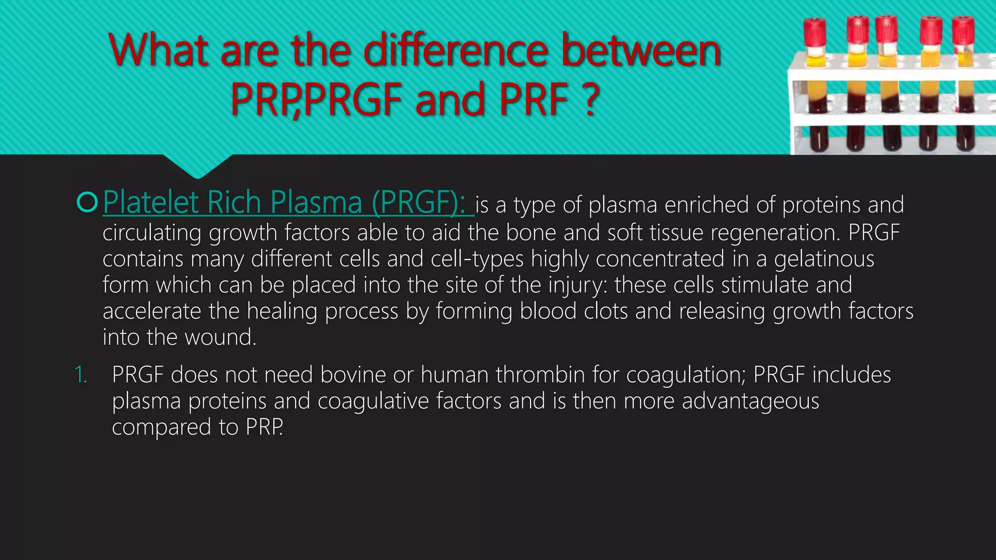 Platelet Rich Fibrin (PRF) in Dentistry | PPTX