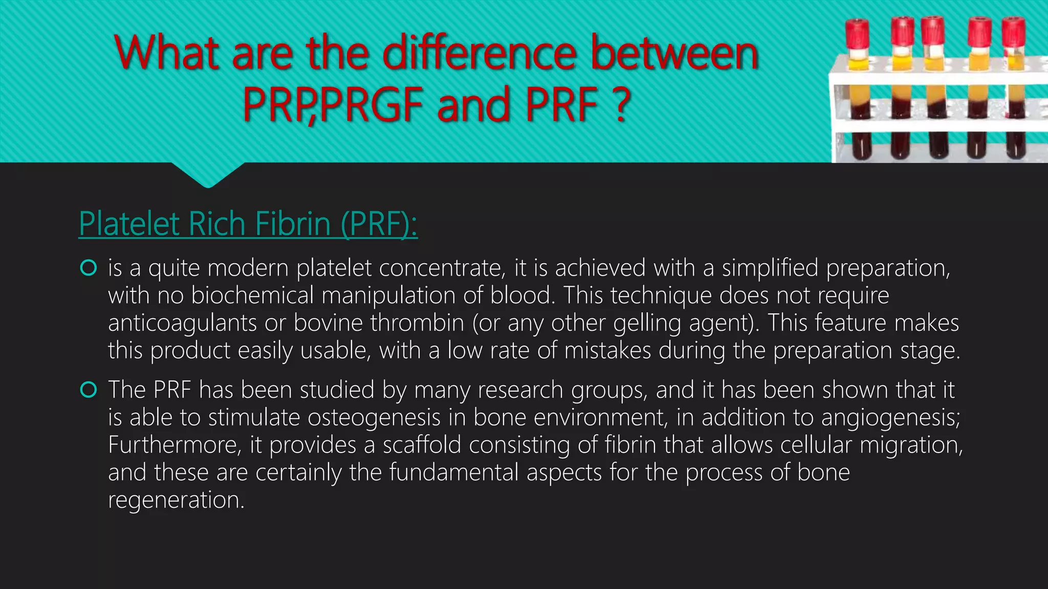 Platelet Rich Fibrin (PRF) in Dentistry | PPTX