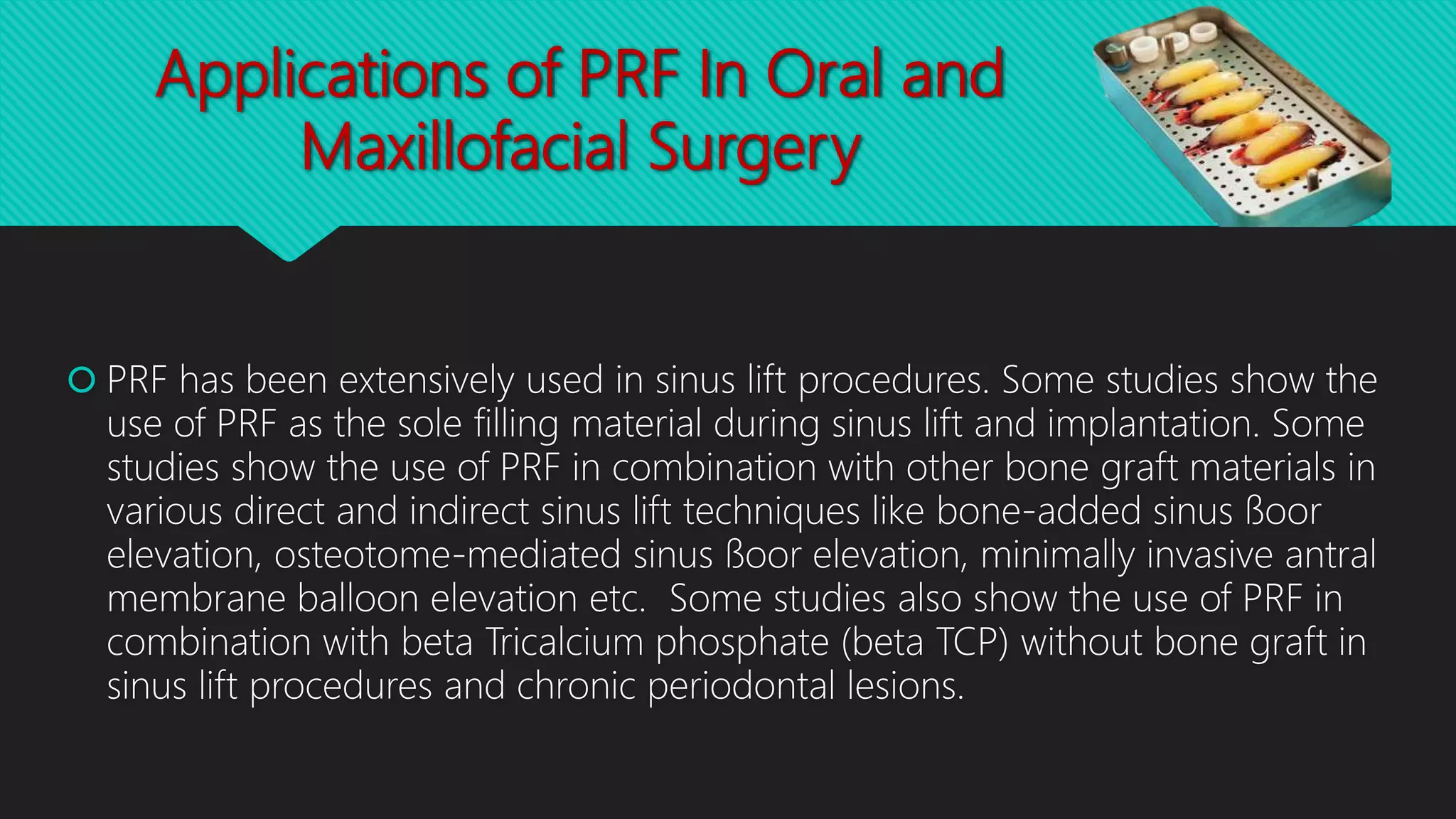 Platelet Rich Fibrin (PRF) in Dentistry | PPTX