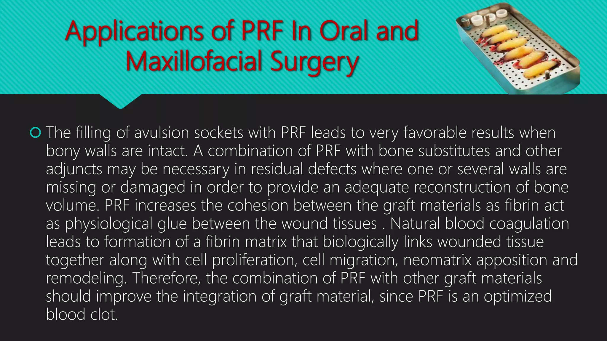 Platelet Rich Fibrin (PRF) in Dentistry | PPTX