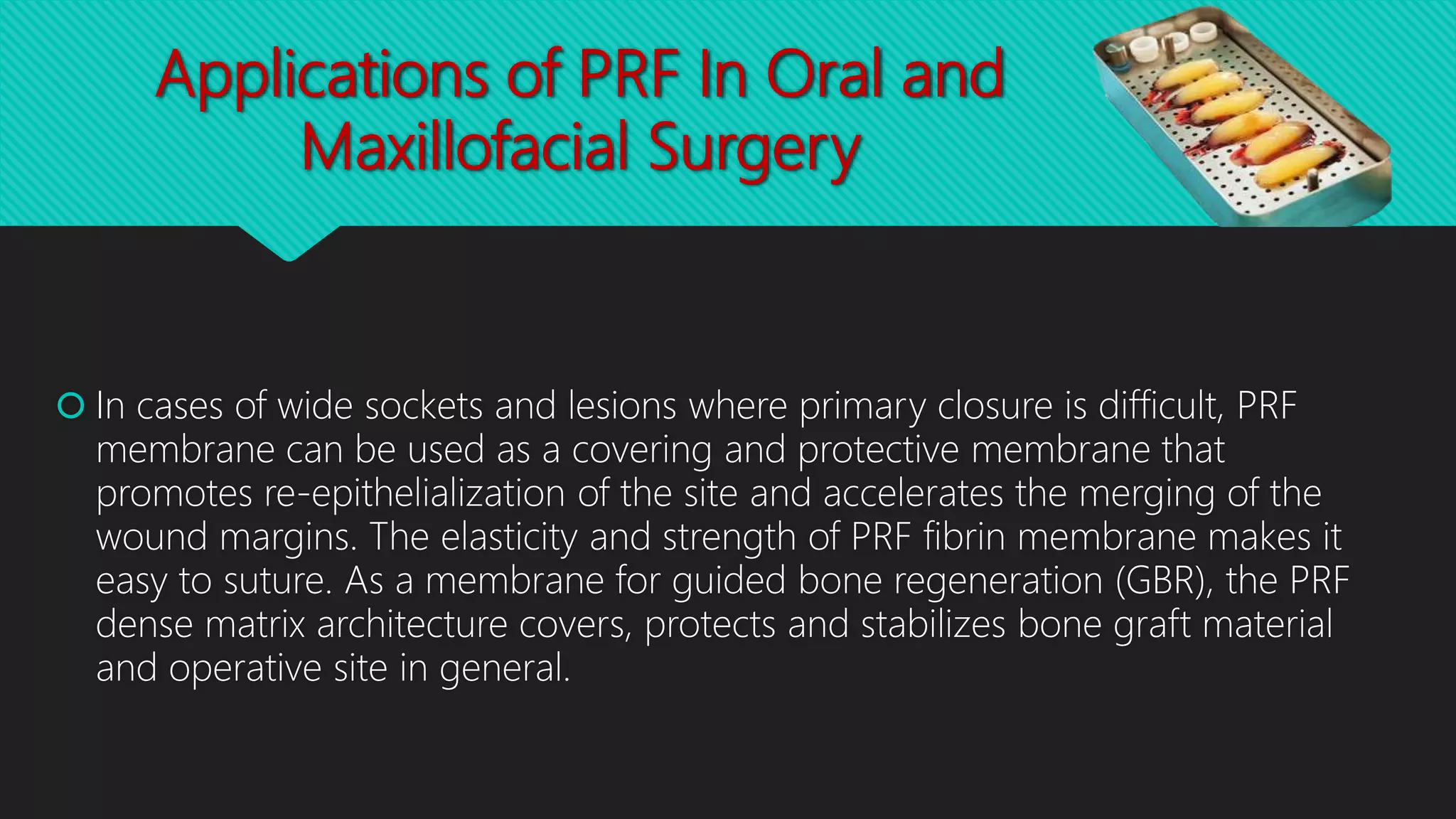 Platelet Rich Fibrin (PRF) in Dentistry | PPTX