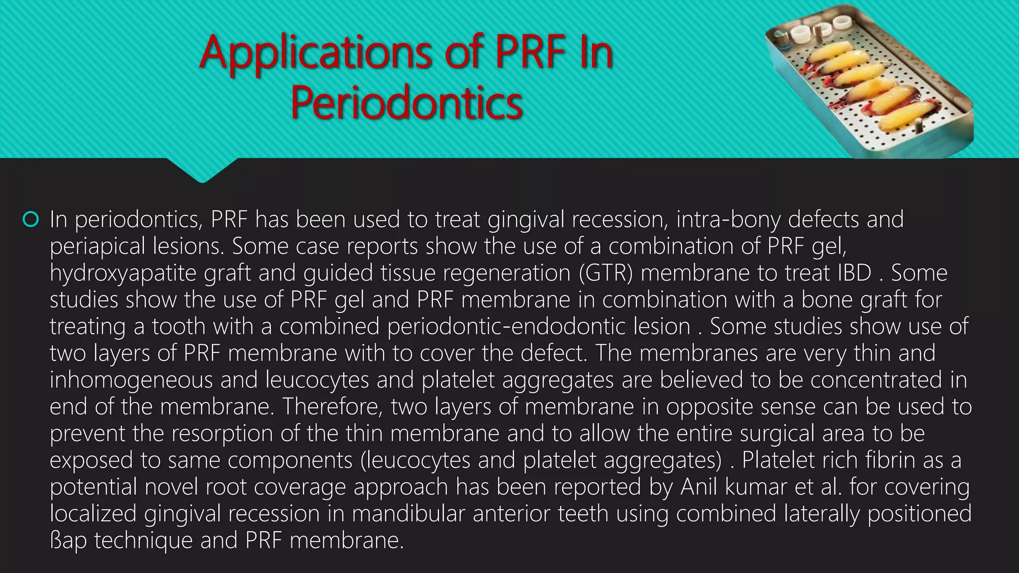 Platelet Rich Fibrin (PRF) in Dentistry | PPTX