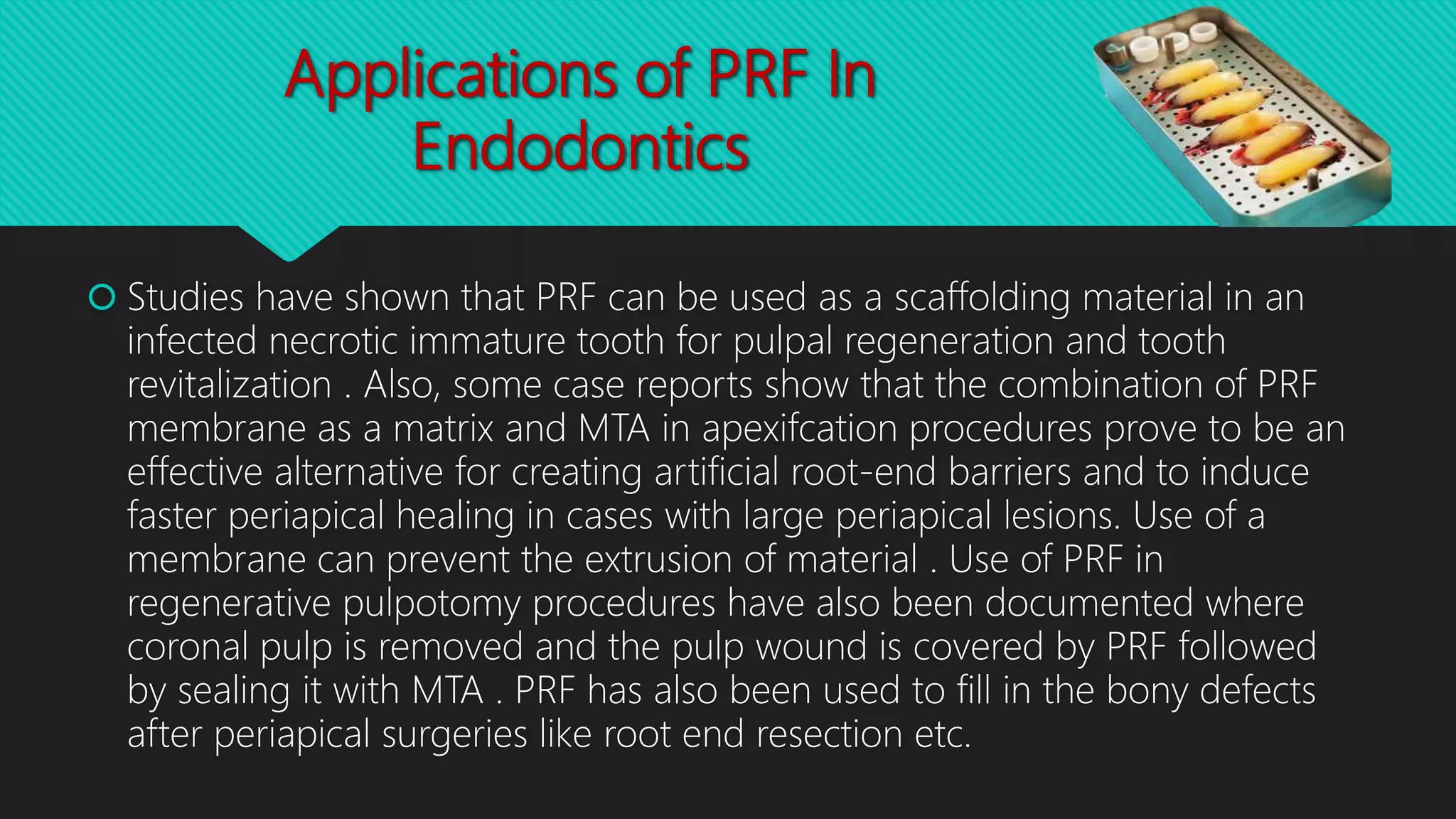 Platelet Rich Fibrin (PRF) in Dentistry | PPTX