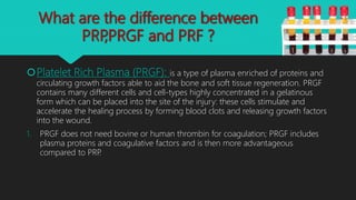 Platelet Rich Fibrin (PRF) in Dentistry | PPTX
