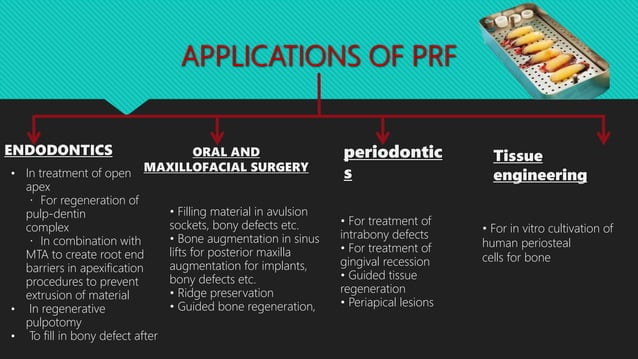 Platelet Rich Fibrin (PRF) in Dentistry | PPTX