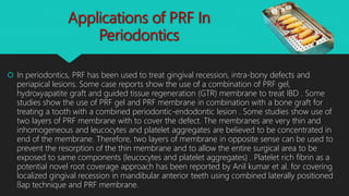 Platelet Rich Fibrin (PRF) in Dentistry | PPTX