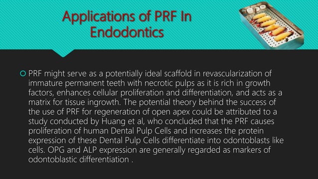 Platelet Rich Fibrin (PRF) in Dentistry | PPTX