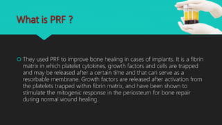 Platelet Rich Fibrin (PRF) in Dentistry | PPTX