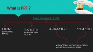Platelet Rich Fibrin (PRF) in Dentistry | PPTX