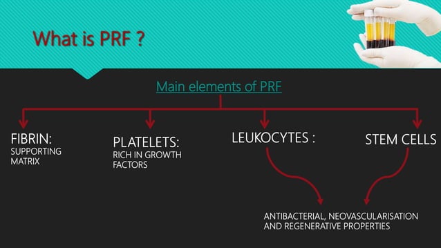 Platelet Rich Fibrin (PRF) in Dentistry | PPTX