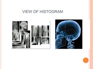 medical imaging of histogram | PPTX