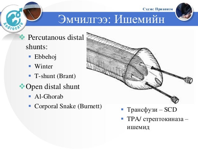 Priapism (Приапизм)
