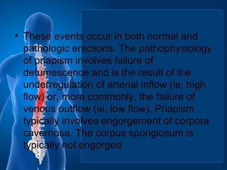 Priapism | PPT