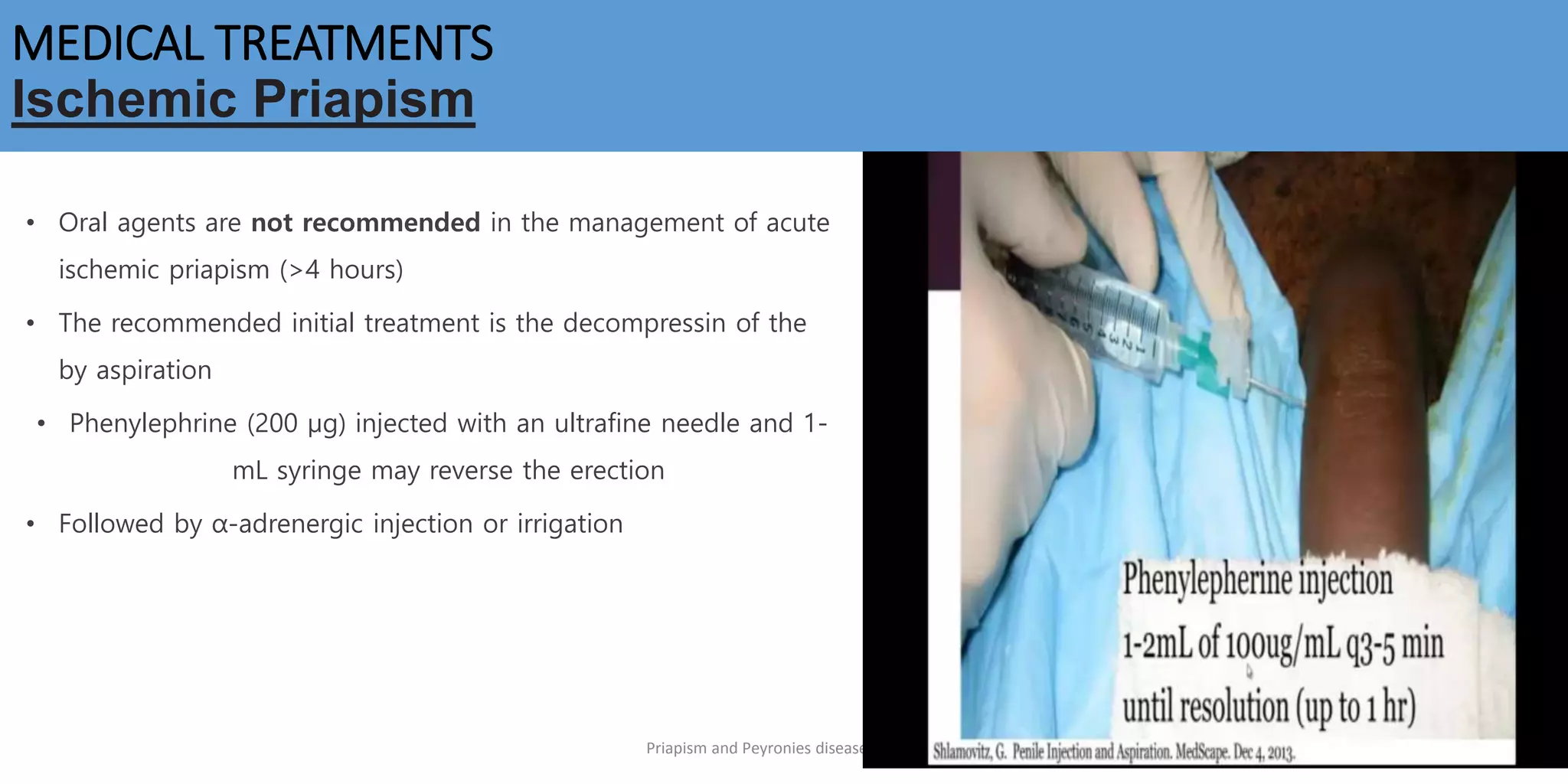 priapism and peyronies disease.pptx