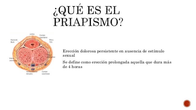 Diagnóstico y tratamiento del priapismo