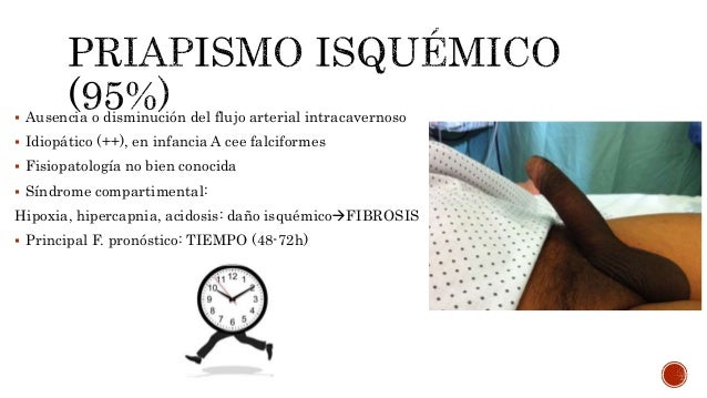 Diagnóstico y tratamiento del priapismo