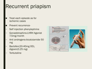 Priapism ppt | PPT