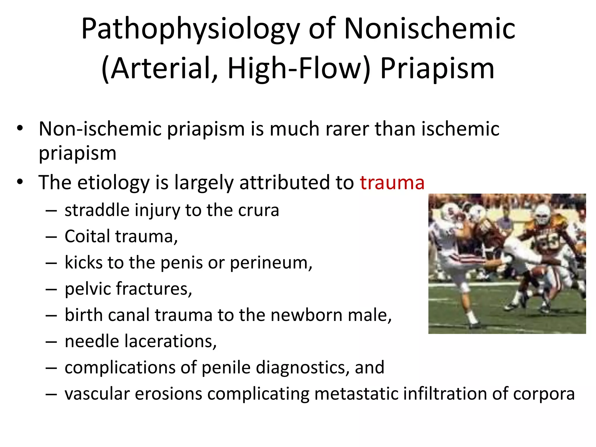 Priapism | PPTX