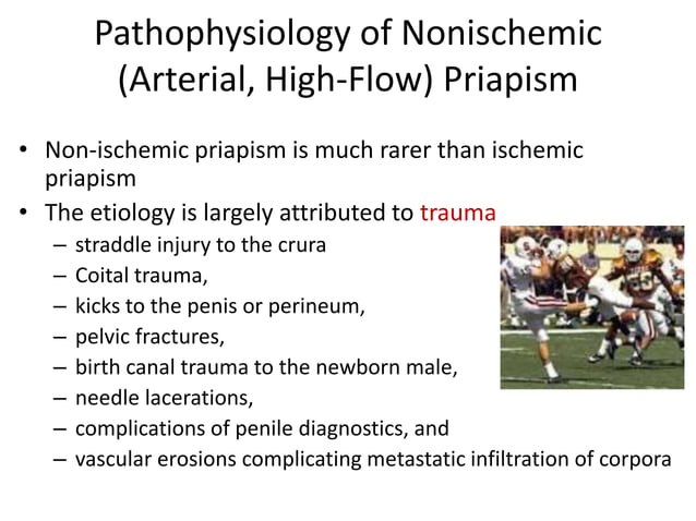 Priapism | PPTX