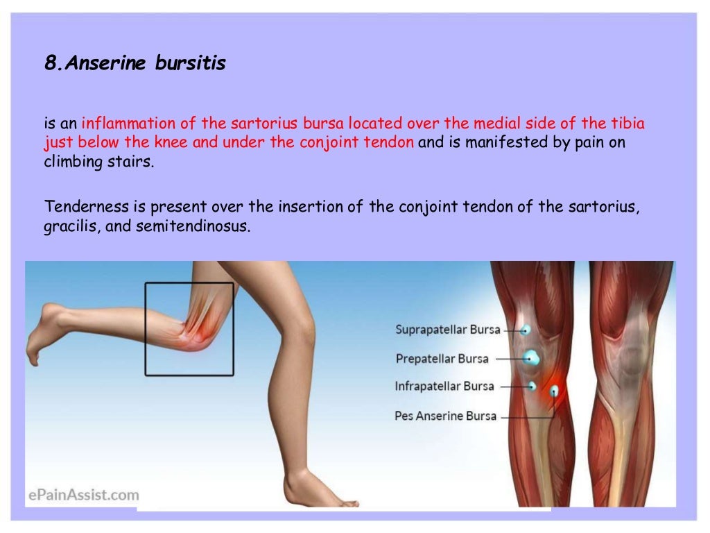 Periarticular Disorders of the Extremities