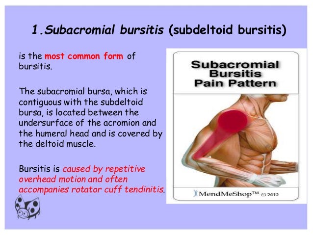 Periarticular Disorders of the Extremities