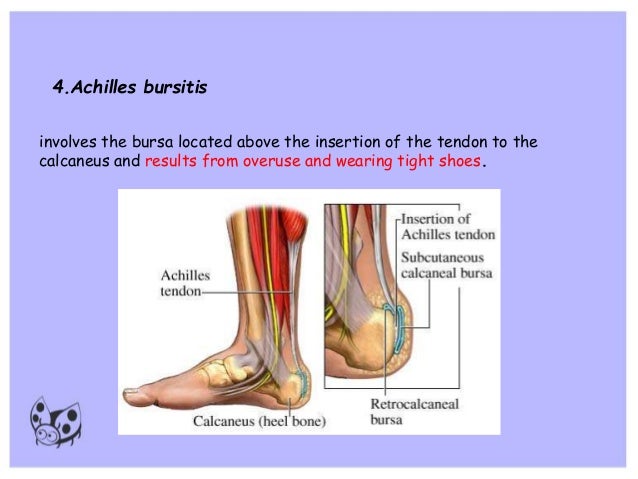 Periarticular Disorders of the Extremities