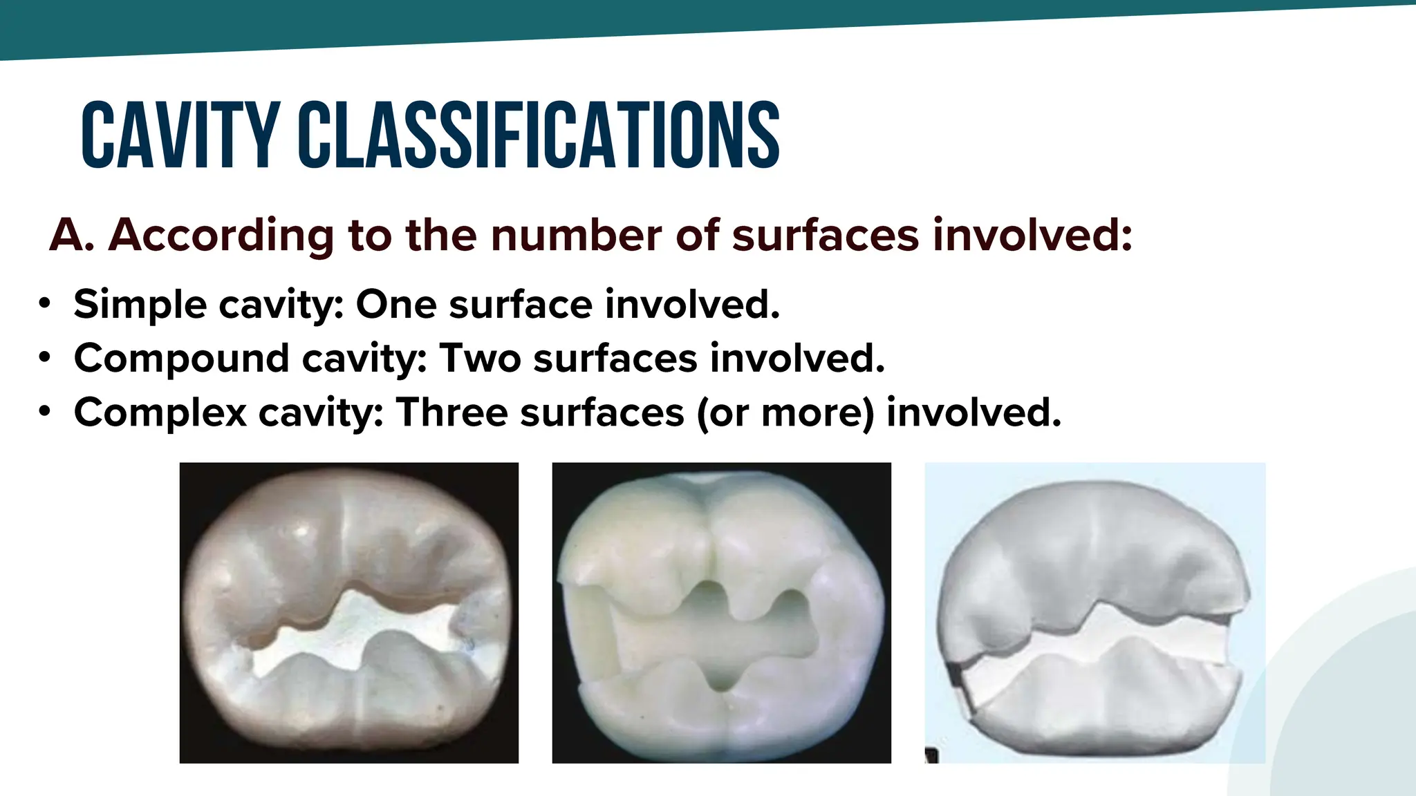principles of cavity preparation... pptx | PPTX
