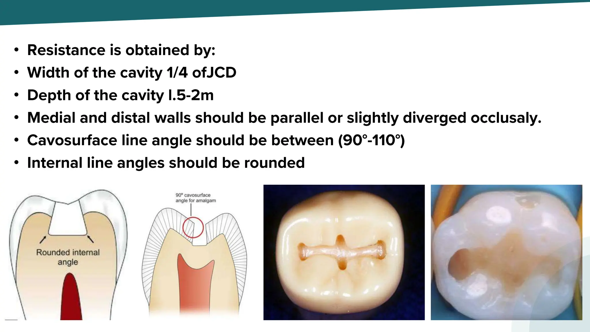 principles of cavity preparation... pptx | PPTX