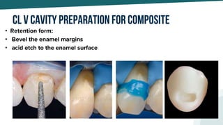 principles of cavity preparation... pptx | PPTX