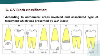 principles of cavity preparation... pptx | PPTX