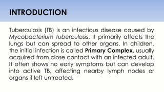PRIMARY COMPLEX case analysis presentation.pptx