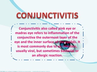 primary health care (conjunctivitis) | PDF