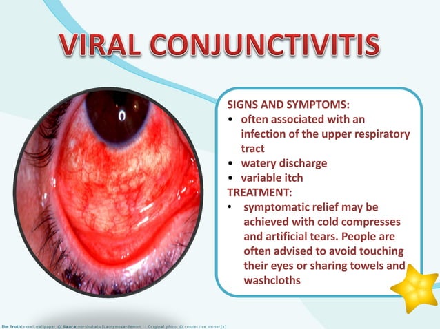 primary health care (conjunctivitis) | PDF