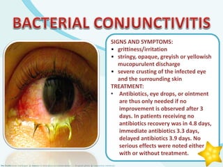 primary health care (conjunctivitis) | PDF