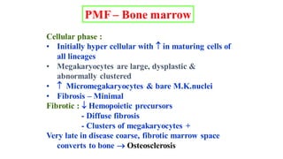 Primary-myelofibrosis.pdf